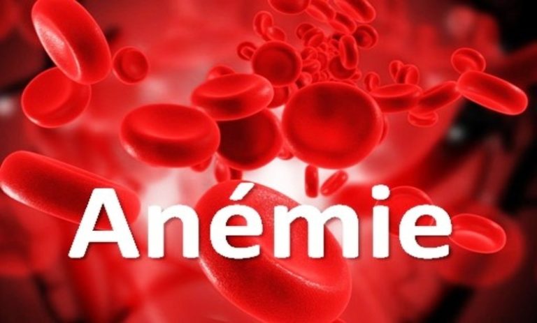 L’anémie : un trouble courant mais à ne pas négliger - FR.Zeen magazine